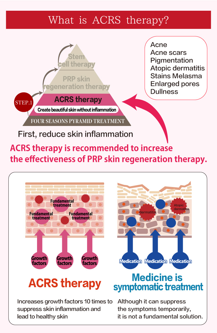 ACRS therapy（skin regeneratioin therapy) | フォーシーズンズ美容皮膚科クリニック東京院｜東京・銀座