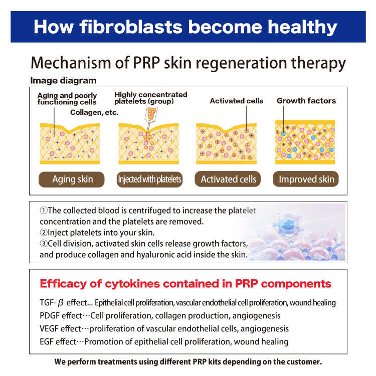 PRP skin regeneration therapy | フォーシーズンズ美容皮膚科クリニック東京院｜東京・銀座