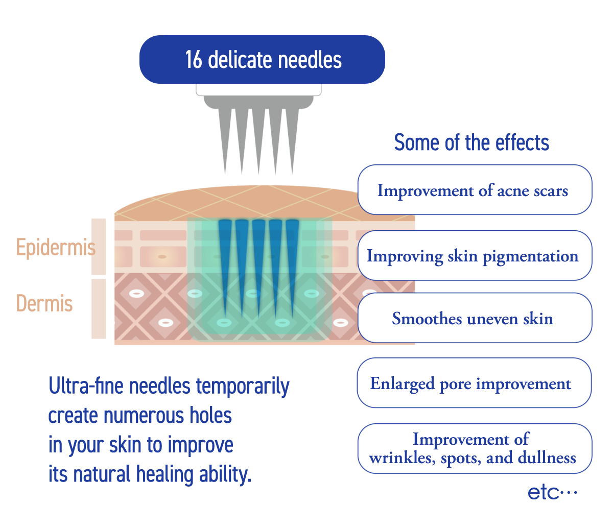 Exosome | フォーシーズンズ美容皮膚科クリニック東京院｜東京・銀座